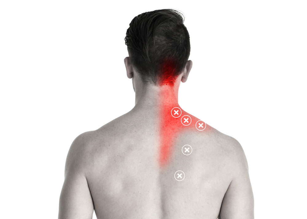 Triggerpunkt – Frisk nakke på nett